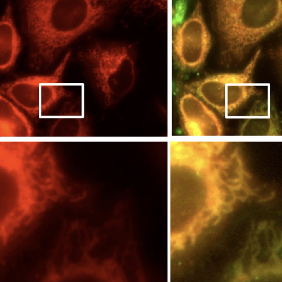 Intracellular Molecular Delivery | Kelley Laboratory Research Group